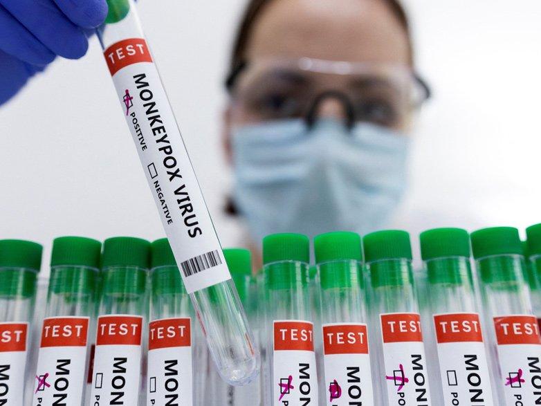 Maymun çiçeğinden nasıl korunabiliriz?