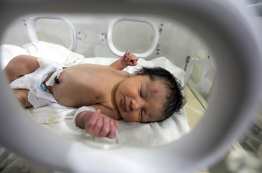 Dünyadan binlerce kişinin evlat edinmek istediği 'mucize bebek ...